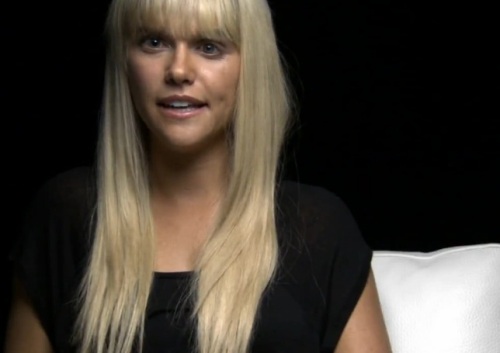 Fashion model's journey past disfiguring aeroplane propeller accident ...